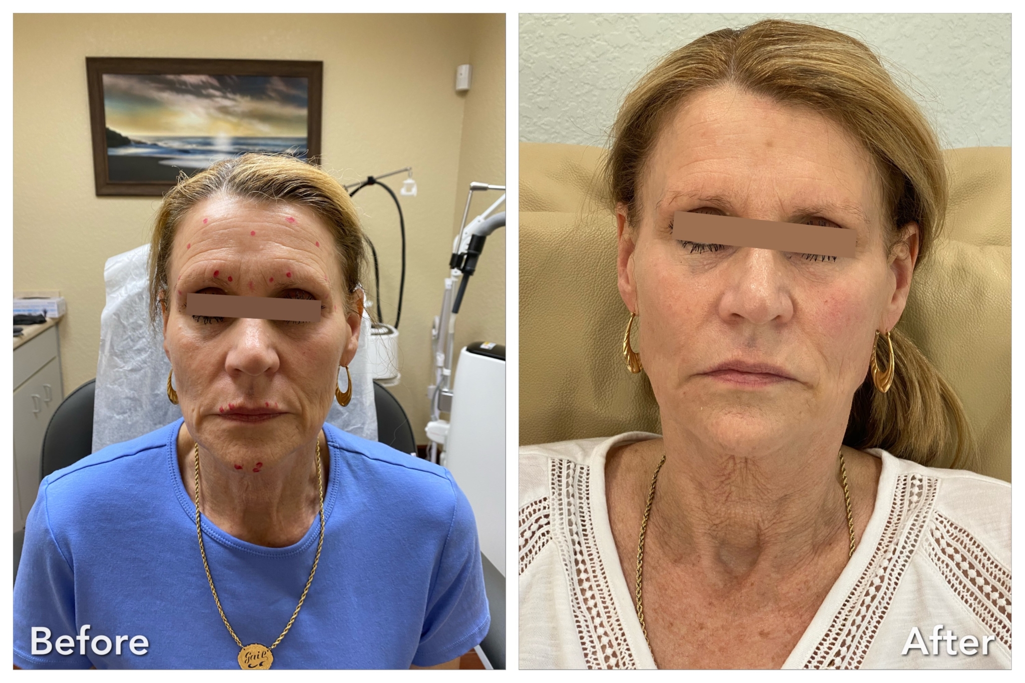 Med Spa Port Orange – Breeze Aesthetics Port Orange, FL